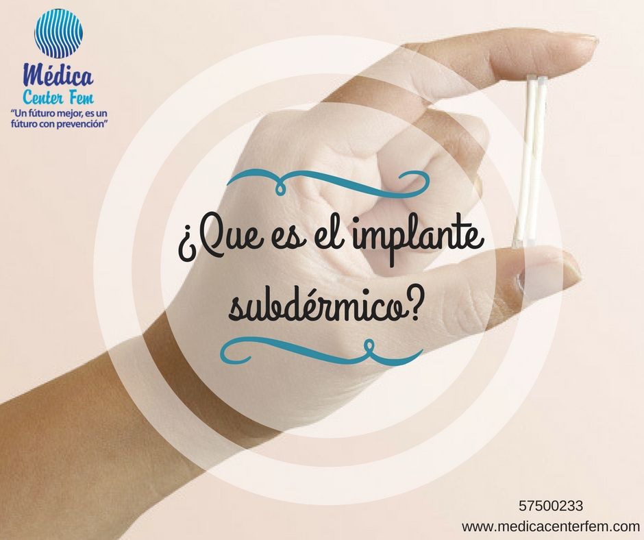 ¿Que es el implante subdermico? – Medica Center Fem