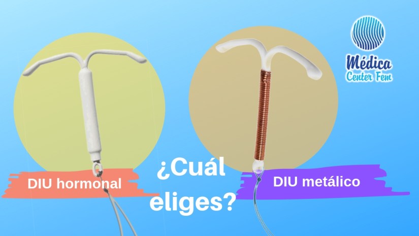 Tipos de DIU – Medica Center Fem