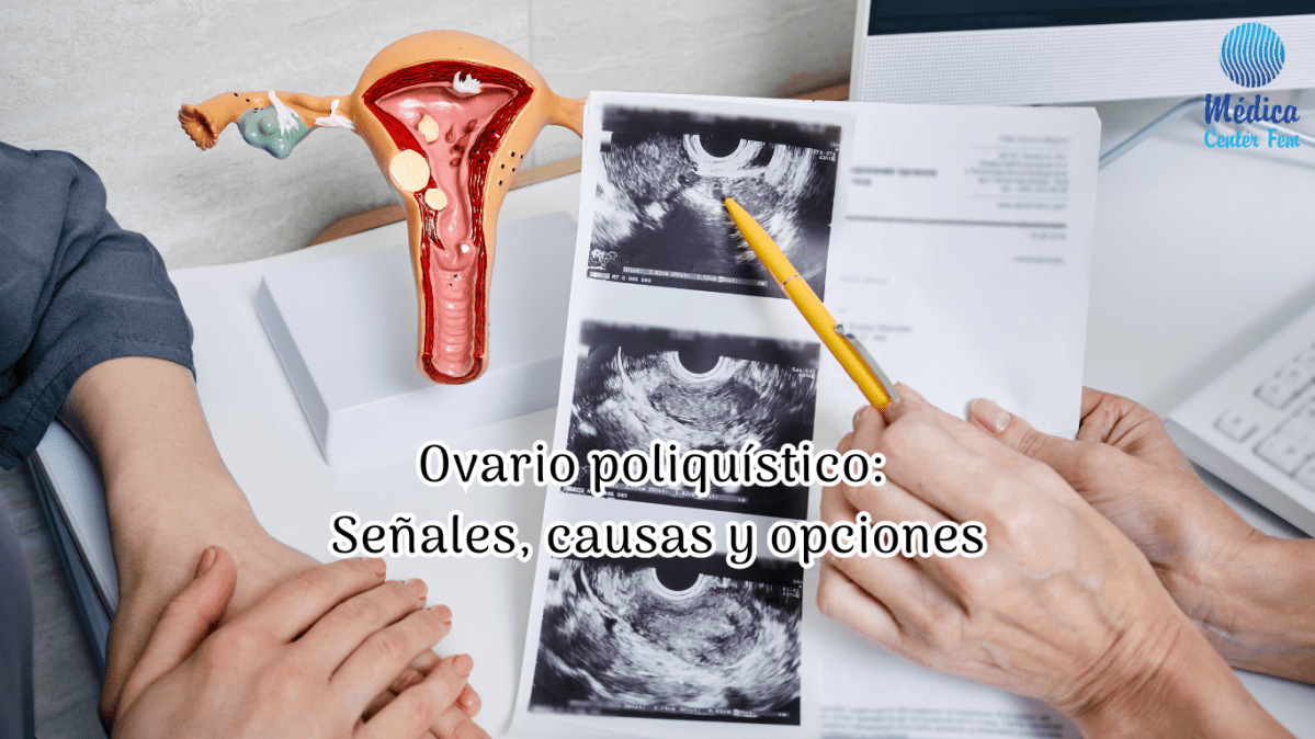 Ovario poliquístico: Señales, causas y opciones – Medica Center Fem