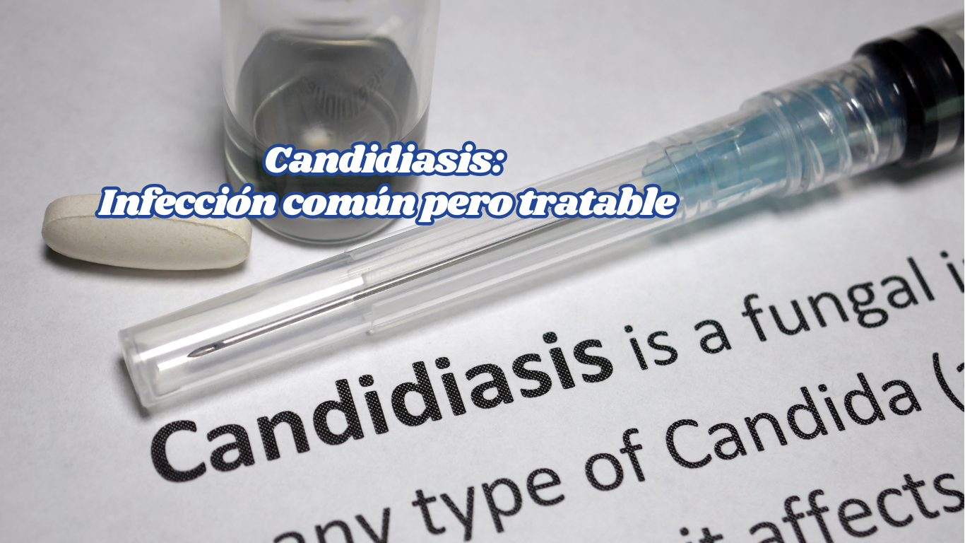 Candidiasis: Infección común pero tratable – Medica Center Fem